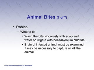 Animal Bites WITH ITS IMPLICATIONS4438619.ppt