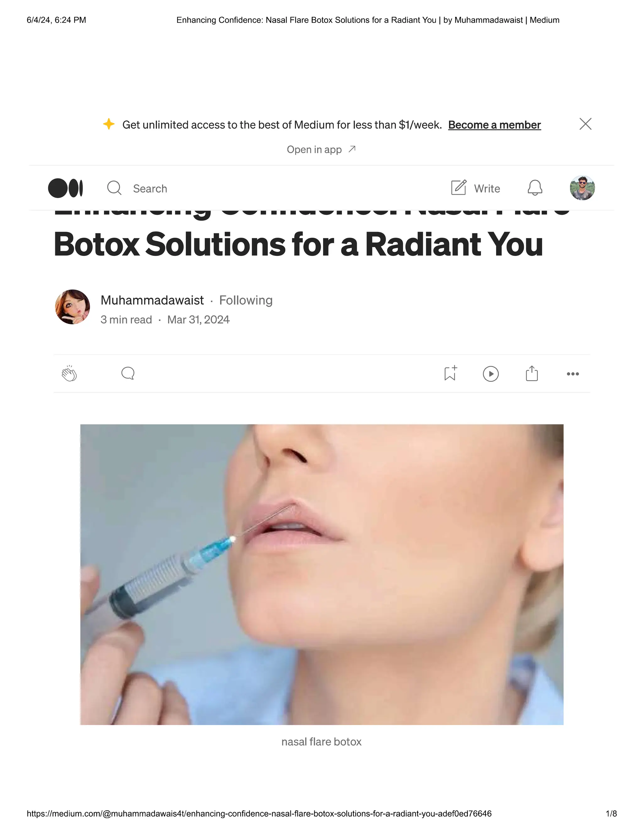 Enhancing Confidence: Nasal Flare Botox Solutions for a Radiant You | PDF