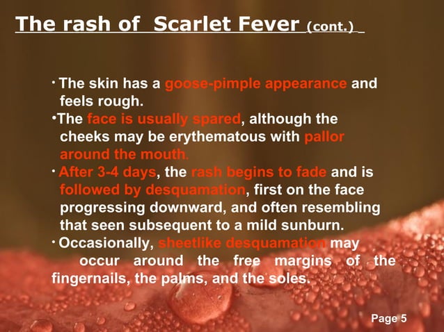 Scarlet Fever | PPT