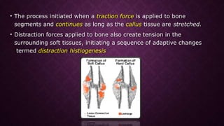 445629097-distraction-osteogenesis-pptx.pptx