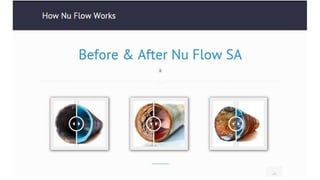 Nu Flow Brochure | PDF