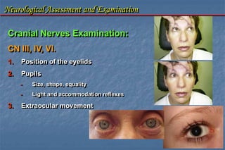 447409371-78222493-Neurological-Assessment-and-Examination-1-ppt.ppt