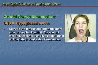 447409371-78222493-Neurological-Assessment-and-Examination-1-ppt.ppt