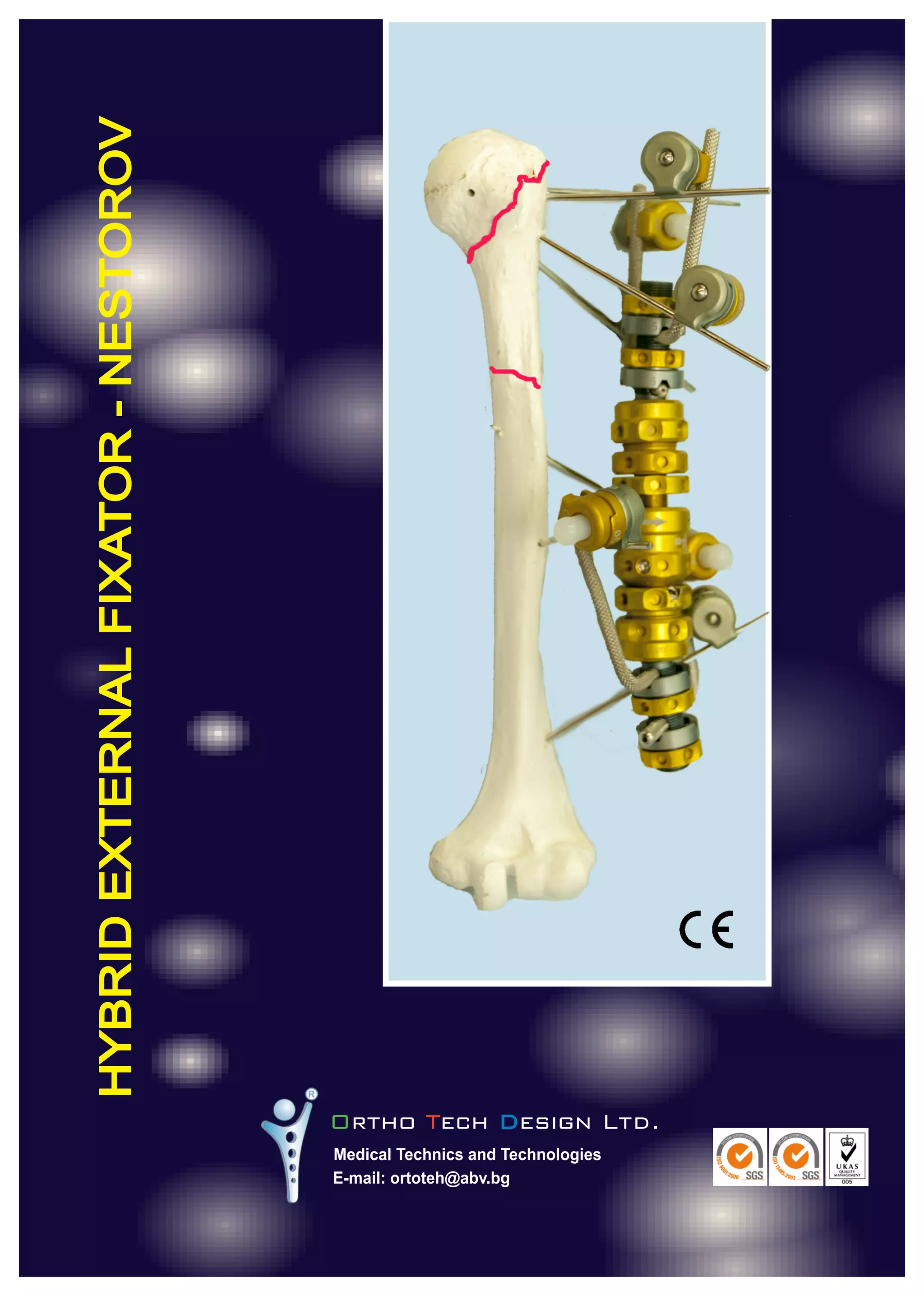 Hybrid External Fixator - Nestorov | PDF | Free Download
