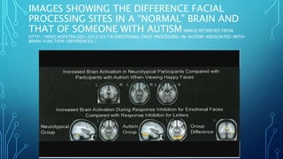 Visual Processing and Autism Spectrum Disorders (1) | PPTX