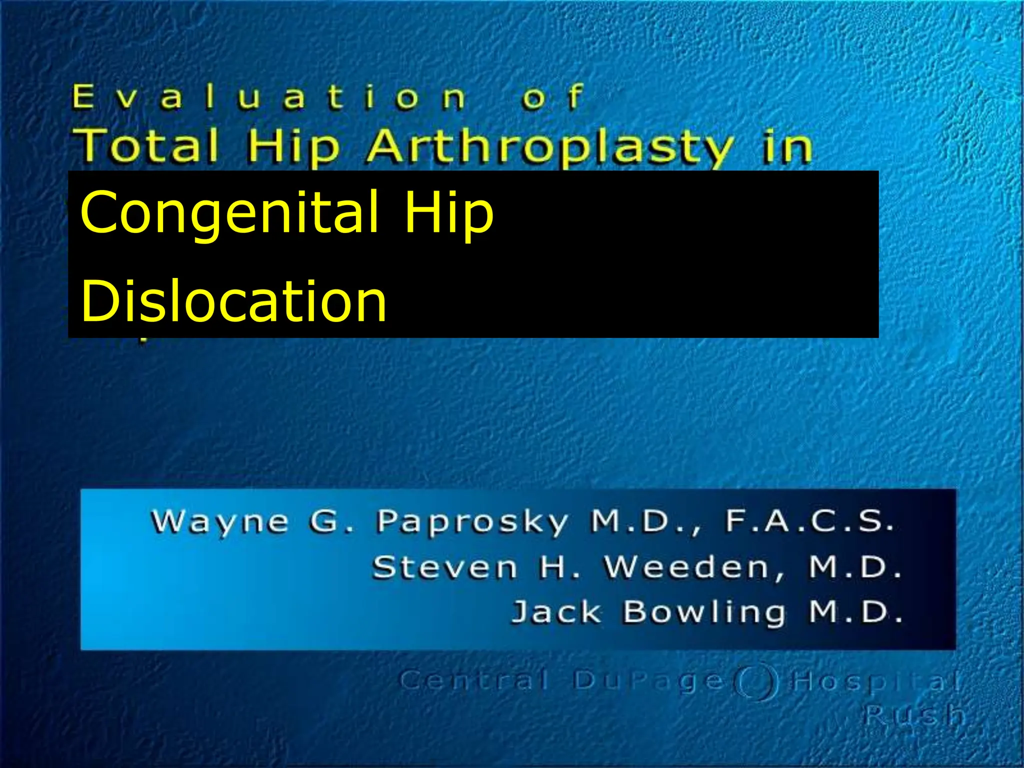 This document about congenital hip dislocation | PPT