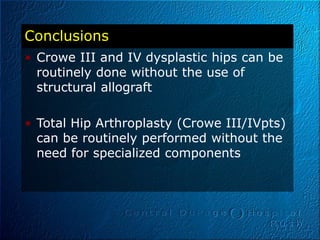 This document about congenital hip dislocation | PPT