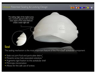microseal-acetabular-system | PPT