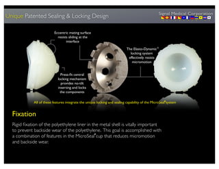 microseal-acetabular-system | PPT