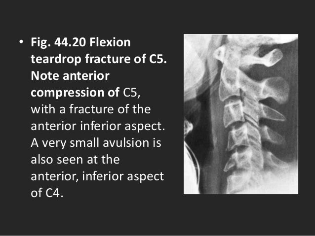 44 DAVID SUTTON PICTURES SKELETAL TRAUMA REGIONAL