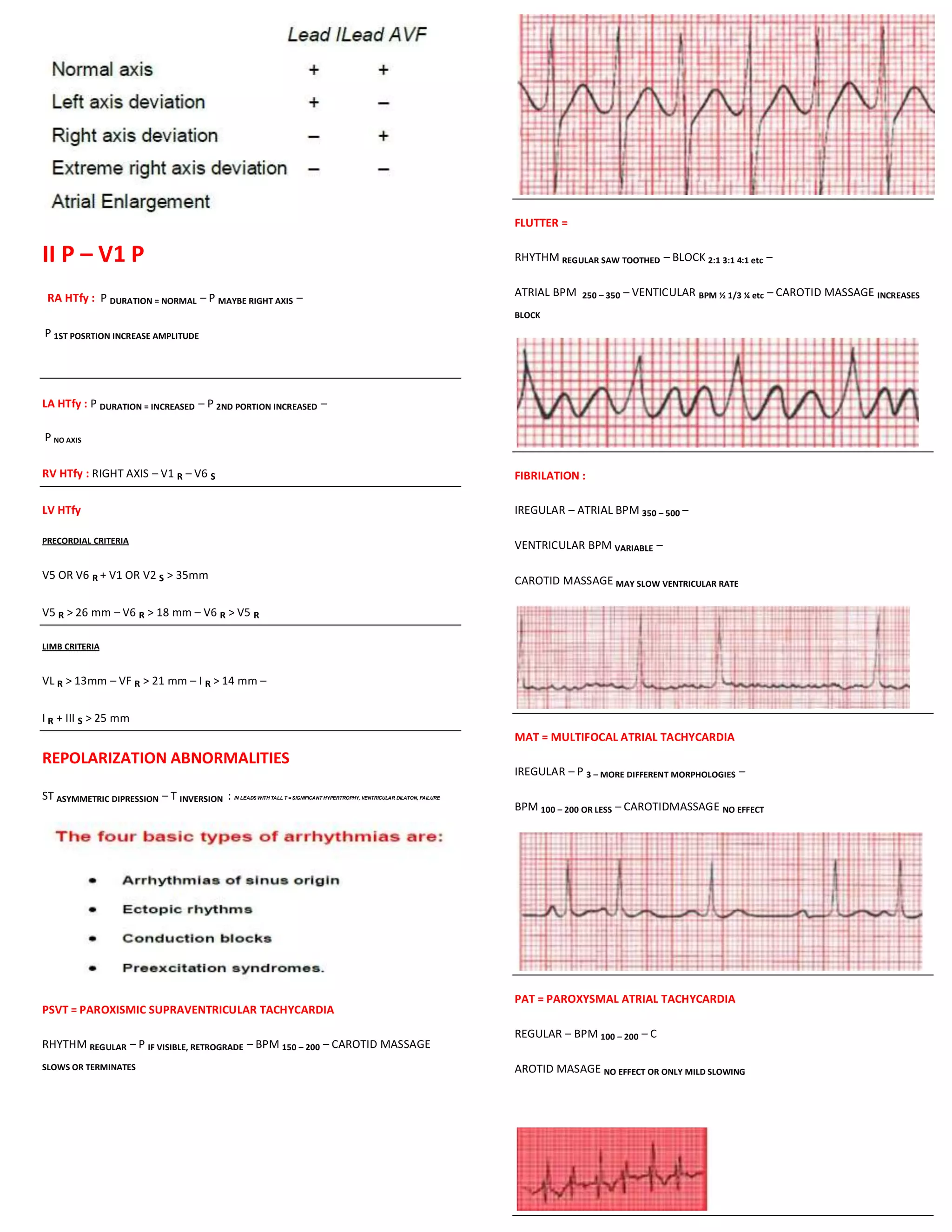 44 Ecg Final | PDF