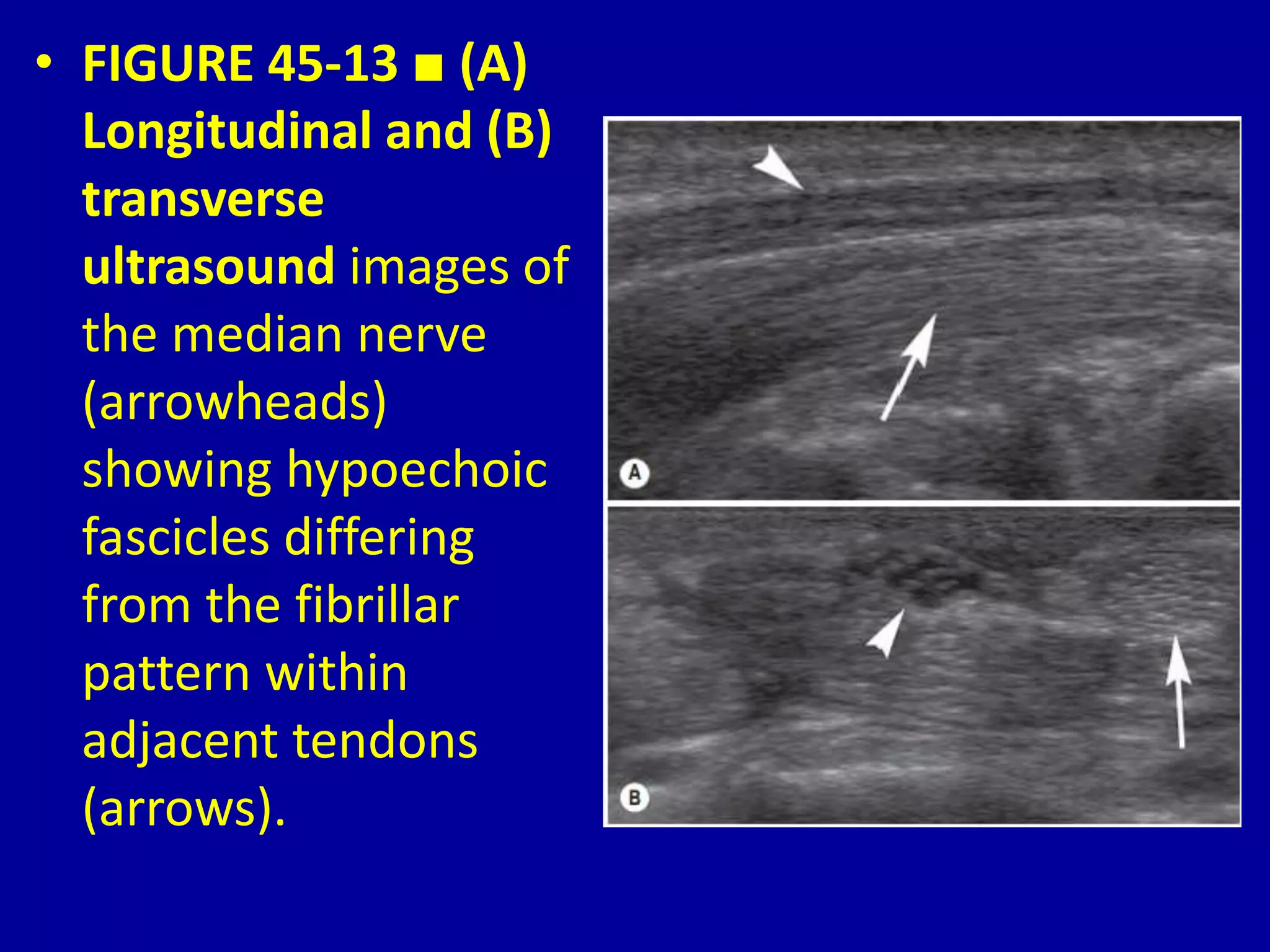 Imaging Techniques and Fundamental Observations for the Musculoskeletal ...