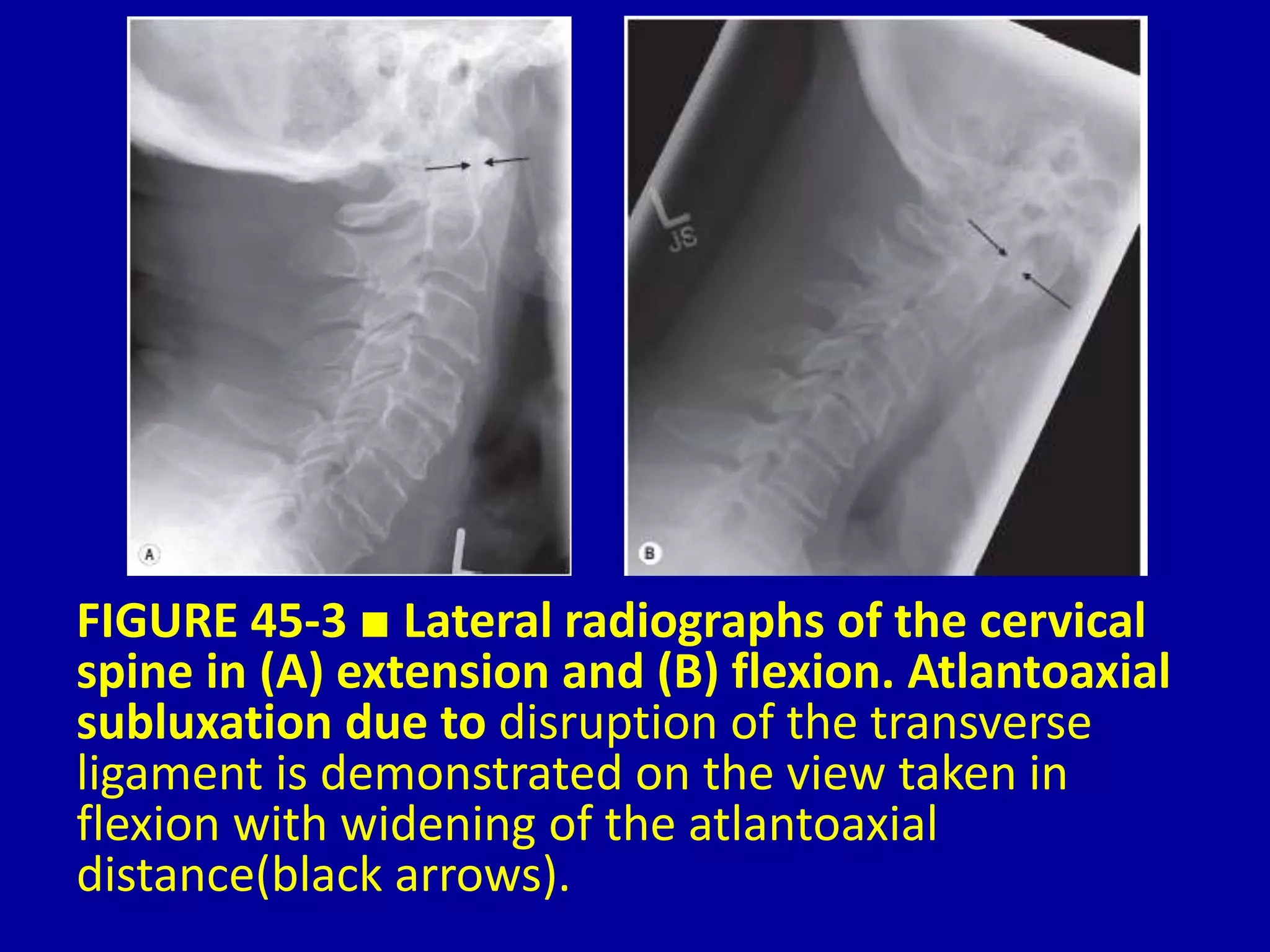 Imaging Techniques and Fundamental Observations for the Musculoskeletal ...