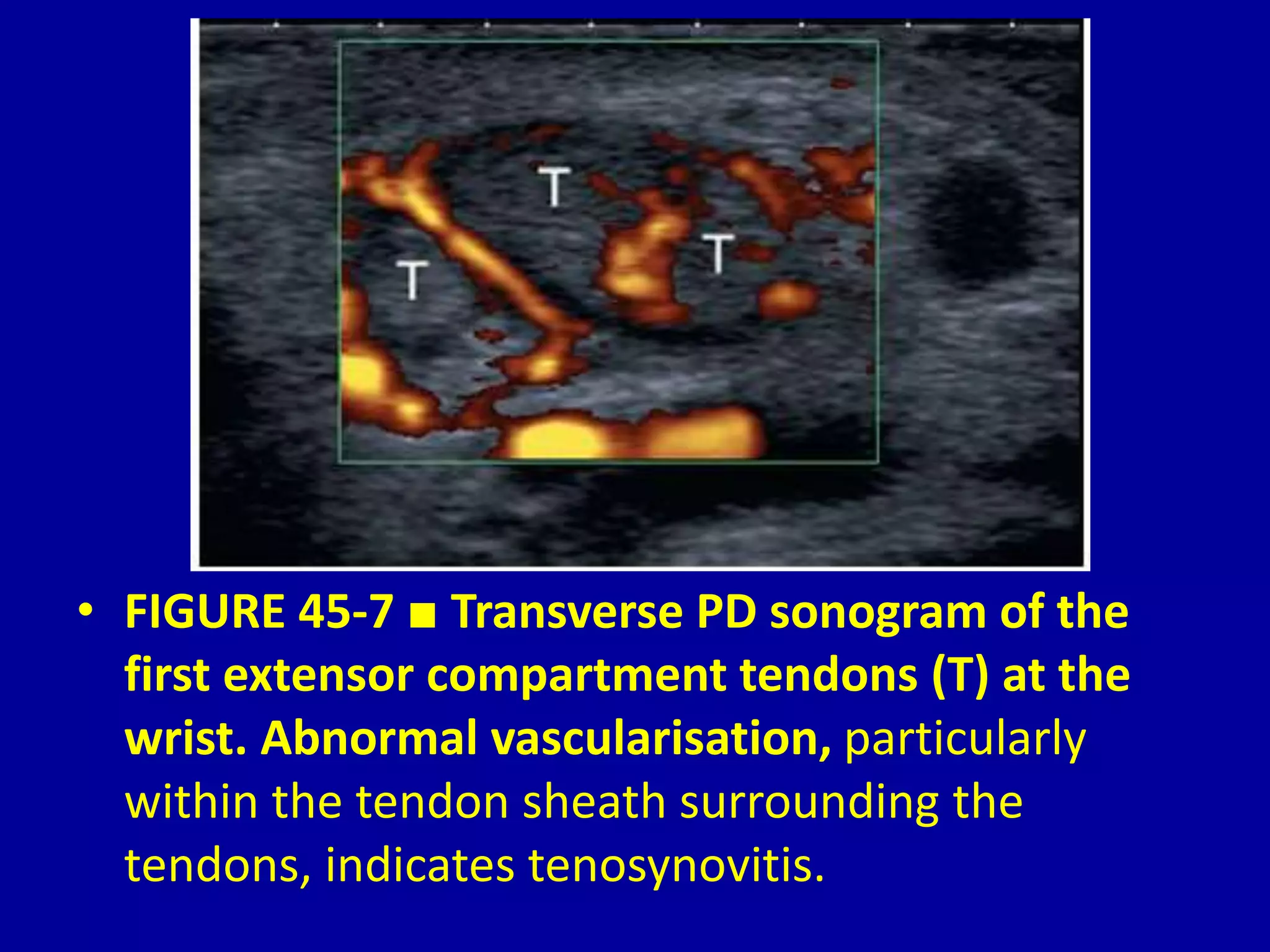 Imaging Techniques and Fundamental Observations for the Musculoskeletal ...
