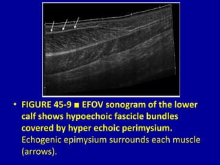 Imaging Techniques and Fundamental Observations for the Musculoskeletal ...