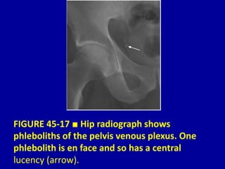 Imaging Techniques and Fundamental Observations for the Musculoskeletal ...