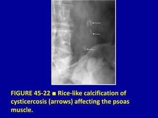 Imaging Techniques and Fundamental Observations for the Musculoskeletal ...