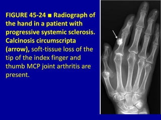 Imaging Techniques and Fundamental Observations for the Musculoskeletal ...