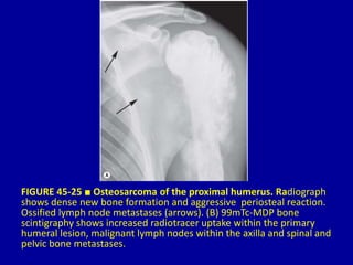 Imaging Techniques and Fundamental Observations for the Musculoskeletal ...