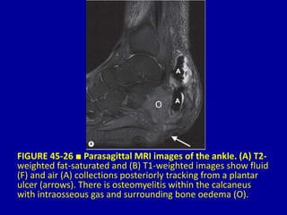 Imaging Techniques and Fundamental Observations for the Musculoskeletal ...