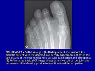 Imaging Techniques and Fundamental Observations for the Musculoskeletal ...