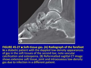 Imaging Techniques and Fundamental Observations for the Musculoskeletal ...