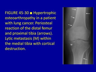 Imaging Techniques and Fundamental Observations for the Musculoskeletal ...