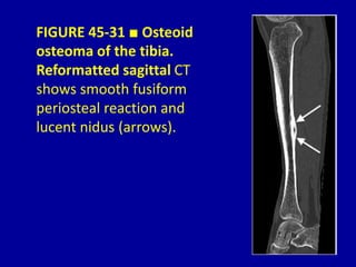 Imaging Techniques and Fundamental Observations for the Musculoskeletal ...