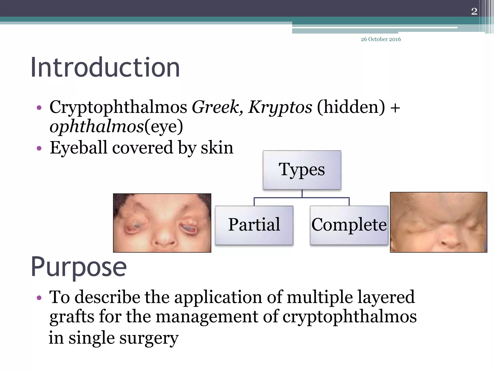 Multiple Layered Free Grafts For The Management Of Cryptophthalmos ...