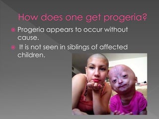 Progeria PPT 1……………………………………………………………….. | PPT