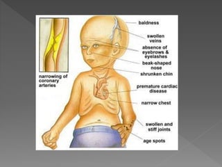 Progeria PPT 1……………………………………………………………….. | PPT