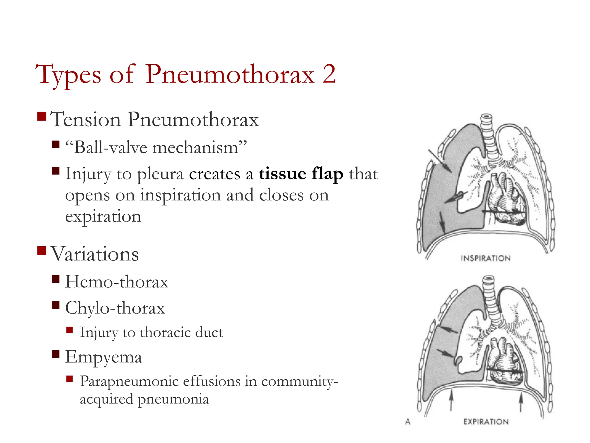 451725480-65478793-Pneumothorax-Final-ppt.ppt
