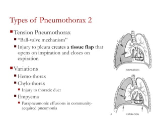 451725480-65478793-Pneumothorax-Final-ppt.ppt