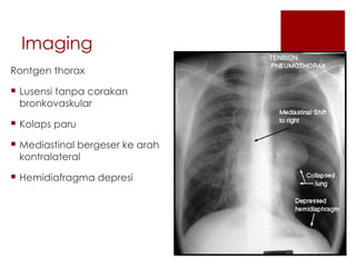 451725480-65478793-Pneumothorax-Final-ppt.ppt