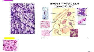 Tejido conectivo denso irregular | Histología | PPTX