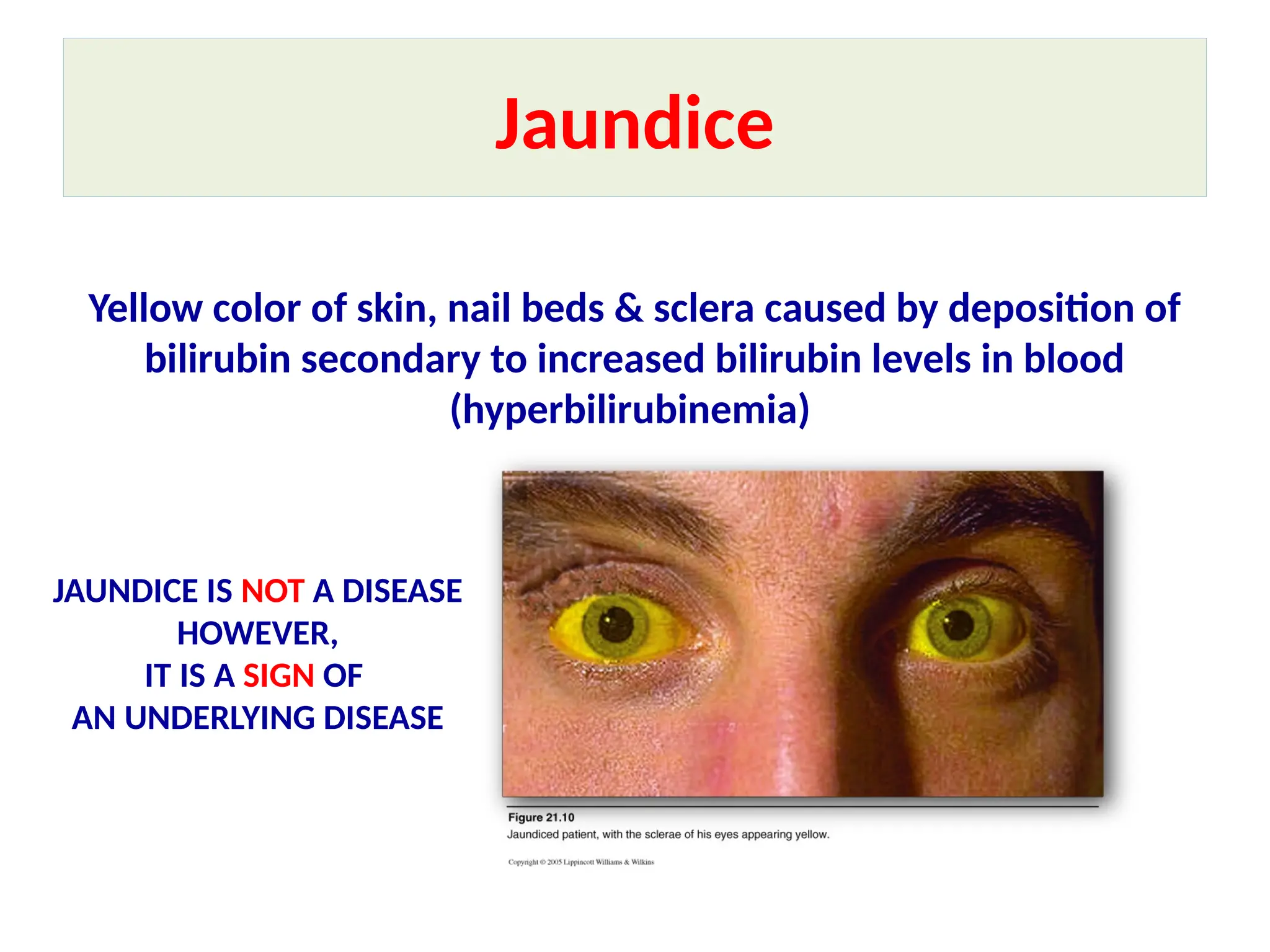 Bilirubin metabolism and jaundice imp.ppt