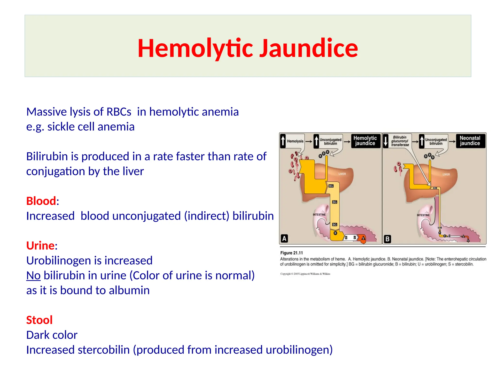Bilirubin metabolism and jaundice imp.ppt
