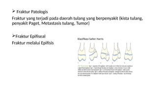 458046020-Klasifikasi-Fraktur tulang .pptx