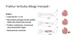 458046020-Klasifikasi-Fraktur tulang .pptx