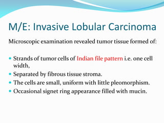 Breast pathology | PDF