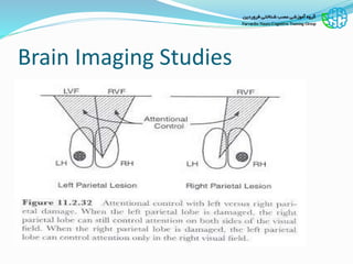 visual perceptual dysfunctions and assessment | PPSX