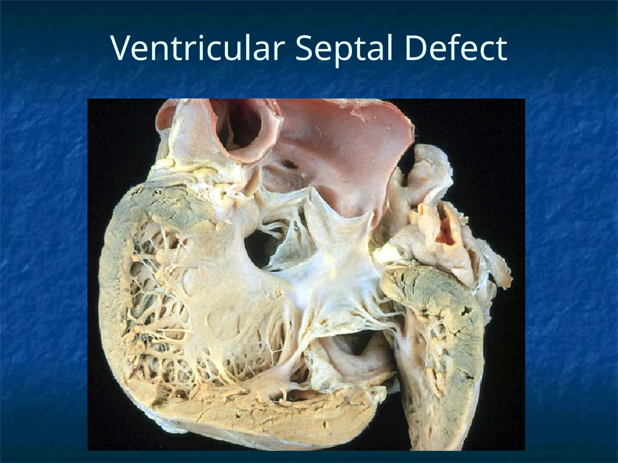 Cardiac Pathology presentation topic.pptx