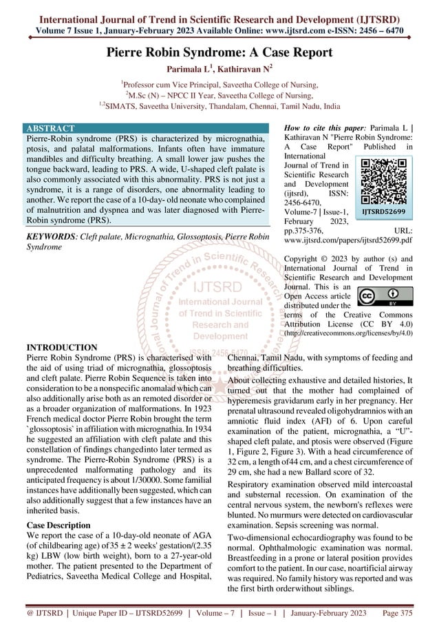 Pierre Robin Syndrome A Case Report | PDF