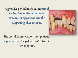 46.TREATMENT OF AGGRESSIVE AND ATYPICAL FORMS OF PERIODONTITIS.pptx