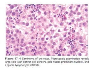 testis pathology | PPTX