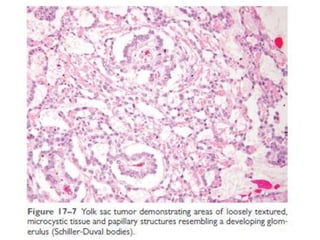 testis pathology | PPTX