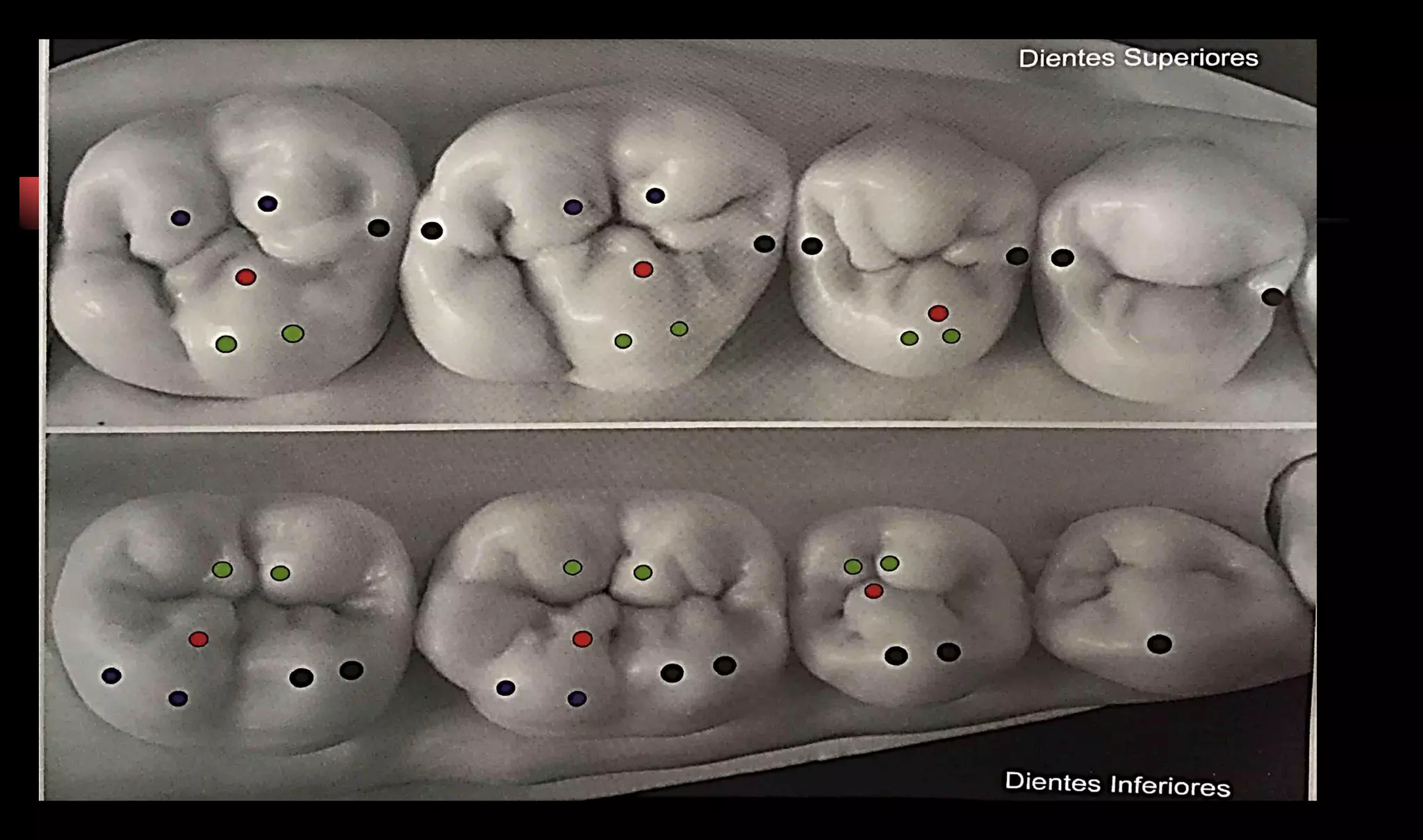 MORFOLOGIA-OCLUSAL-DIENTES-POSTERIORES-pdf.pdf
