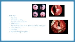 CBD laryngopharyngeal reflux | PPTX