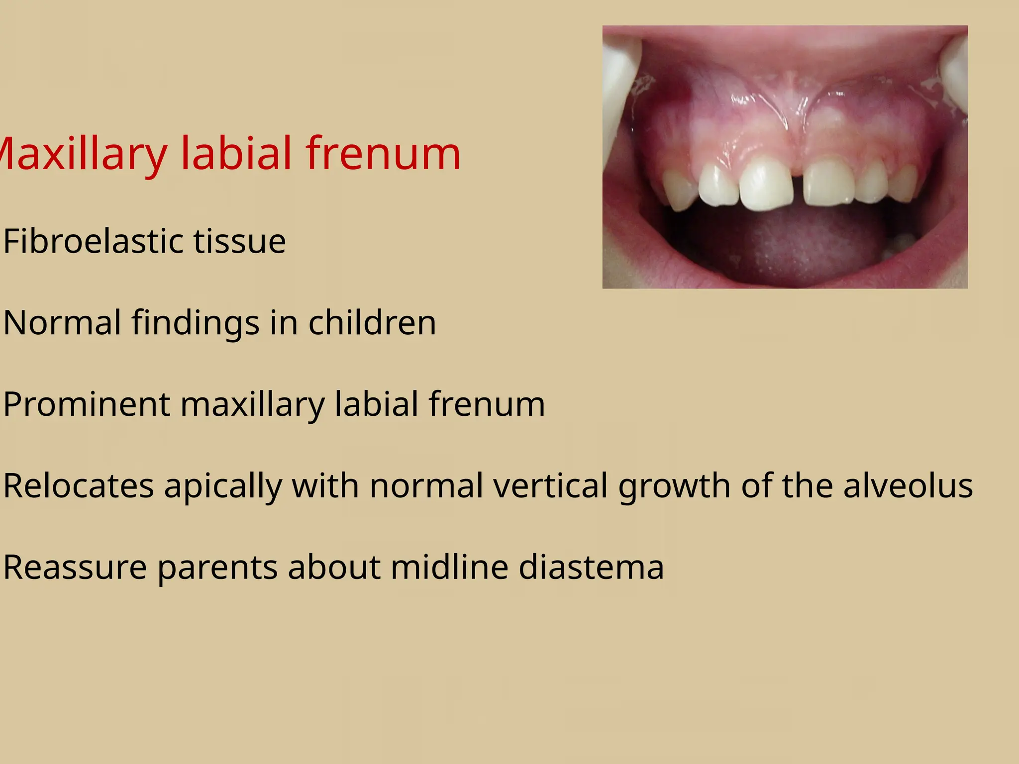 463385906-Minor-oral-surgical-procedures-in-children-class.pptx