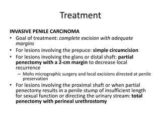 PENILE CARCINOMA | PPT